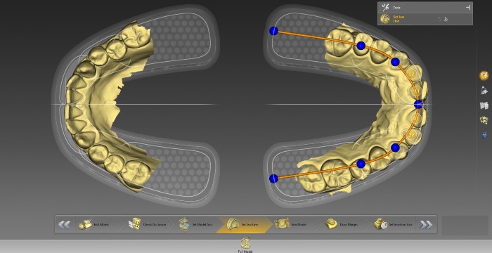 Services | SKYZIR - For Crowns, Bridge, Implants, & Aligners Scan